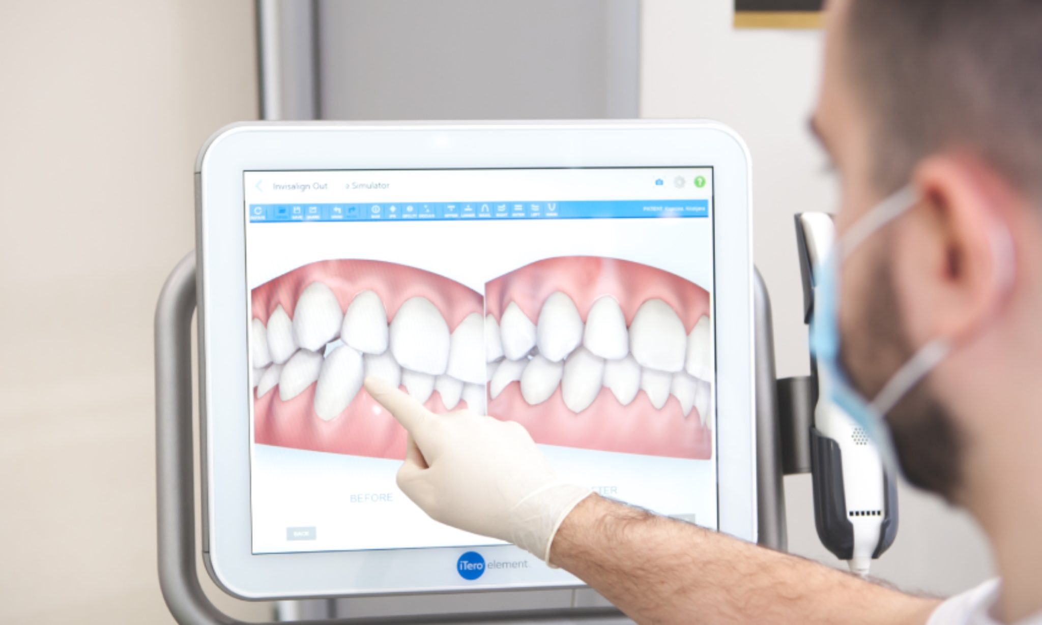 ClearCorrect clear aligners - Dentech